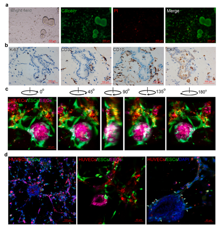 BIOACT MATER | 浙大张松英、冯晔、戴永东，基于微流控芯片的血管化子宫内膜模型：细胞间旁分泌机制研究 - 微流控信息网