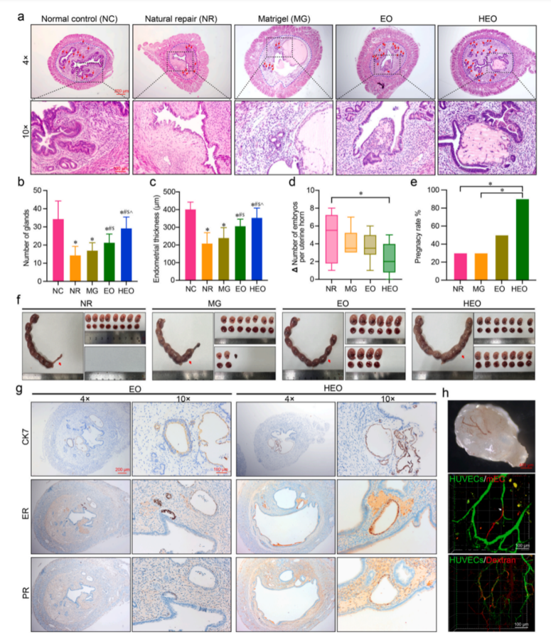 BIOACT MATER | 浙大张松英、冯晔、戴永东，基于微流控芯片的血管化子宫内膜模型：细胞间旁分泌机制研究 - 微流控信息网