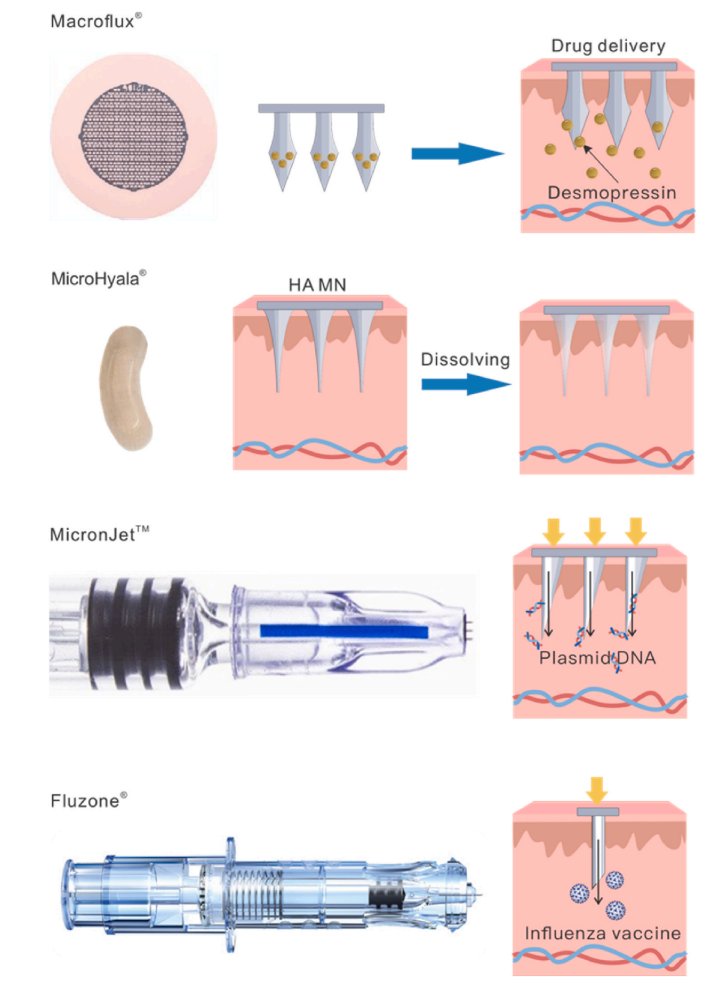 BIOACT MATER | 综述：微针技术基础、发展以及在生物传感和药物递送中的应用 - 微流控信息网